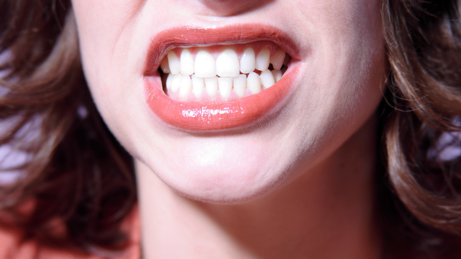 Anemia Gums And Your Oral Health - My BEST Dentists Journal ...
