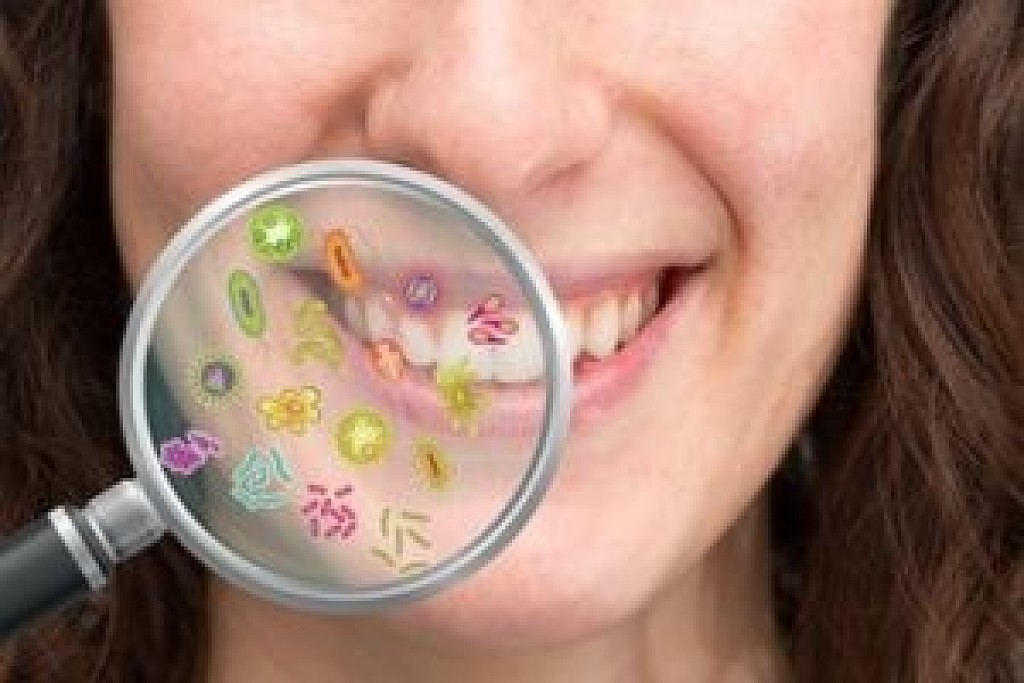 Three Types Of Bacteria In The Mouth And What They Do - My BEST ...
